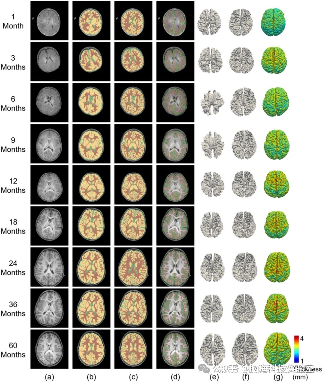 iBEAT V2.0：一个多站点的、基于深度学习的婴儿大脑皮层表面重建Pipeline - 知乎