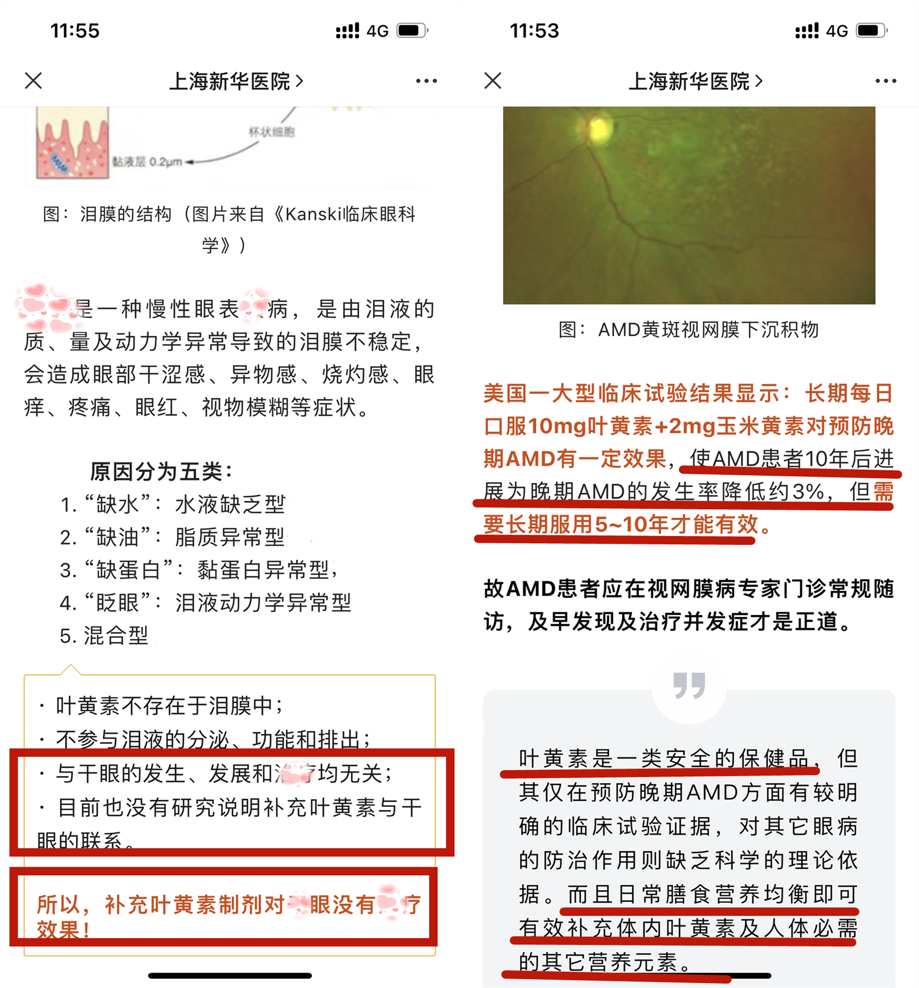 每天对着电脑十个小时的工作和学习,怎么保护眼睛呢?吃叶黄素有用嘛? 知乎