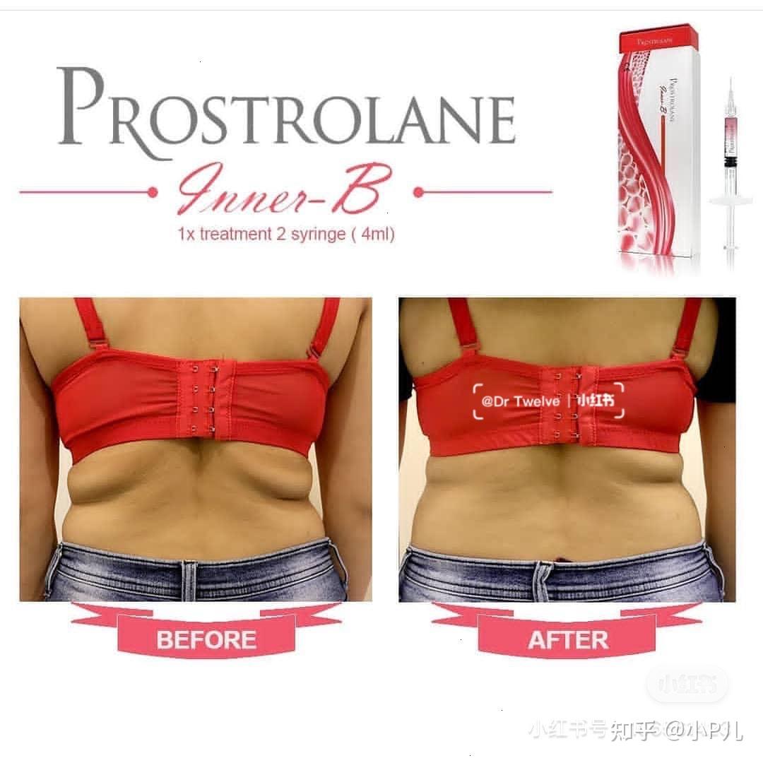 欧洲🇪🇺CE认证三类医疗器械Prostrolane Inner B（缩脂肽） - 知乎