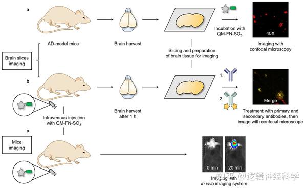 Nat Protoc︱华东理工大学郭志前课题组淀粉样蛋白Aβ检测突破性进展：助力阿尔兹海默症早期诊断 - 知乎