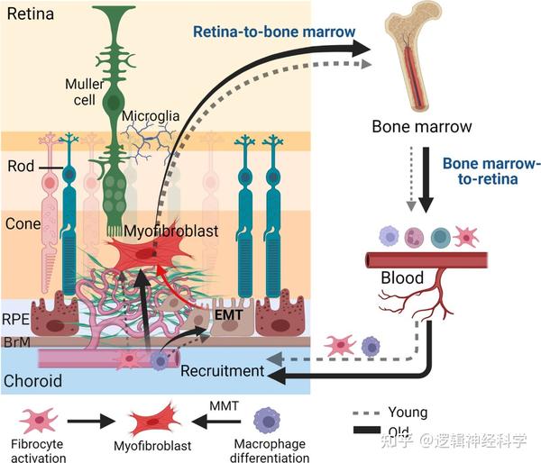 J Neuroinflammation︱爱尔眼科徐和平团队揭示老龄加重视网膜纤维化的机制 - 知乎
