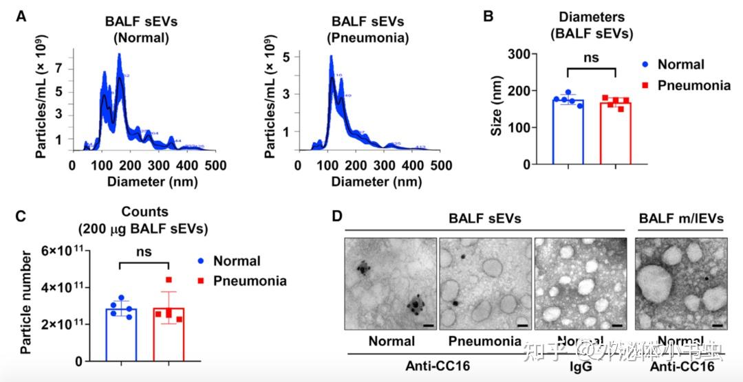 文献分享【Mol. Ther.】外泌体装载CC16蛋白治疗肺急性炎症反应 - 知乎