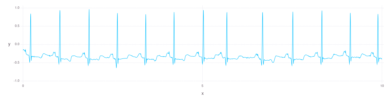 心电信号数据处理 - 知乎