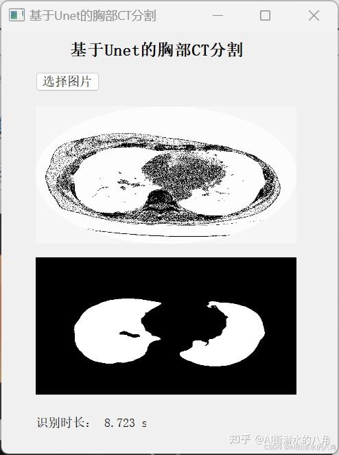 医学图像算法之基于Unet的胸部CT分割 - 知乎