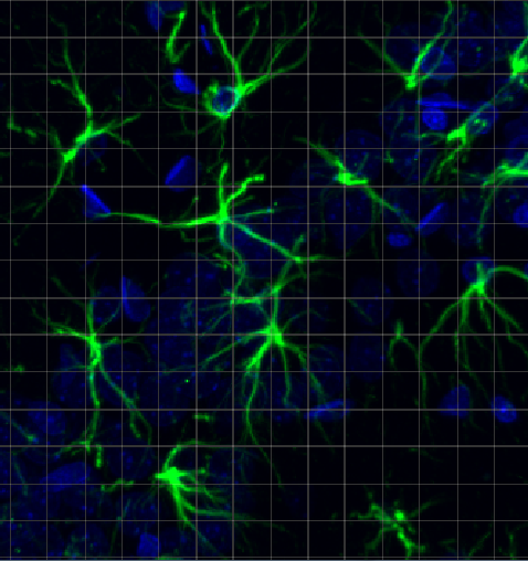 Imagej图像处理实践（ImageJ学习-图像处理 545367350） - 知乎