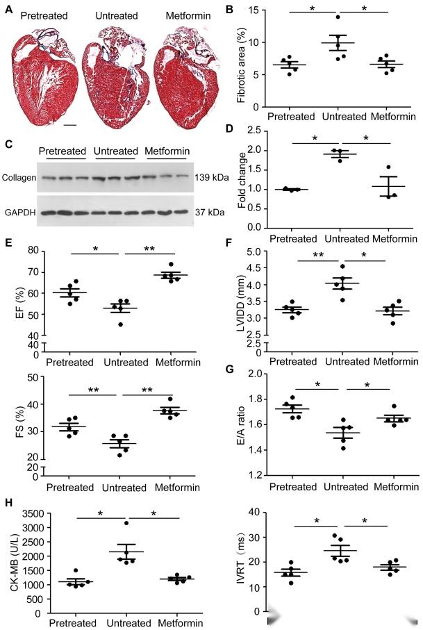 Cell Death Differ︱尹海芳团队揭示杜兴肌肉萎缩症新作用机制：转录因子Wt1激活心外膜细胞分化促进心肌纤维化 - 知乎