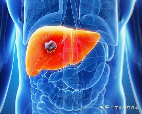 NHANES数据库练手DAY1（年龄与肿瘤） - 知乎