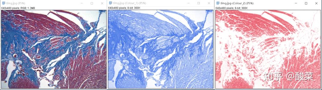 ImageJ高效图片分析技巧 - 知乎
