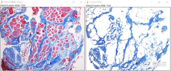 ImageJ高效图片分析技巧 - 知乎