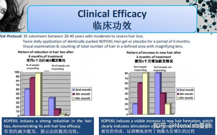 亚美尼斯（Kopexil）介绍 - 知乎