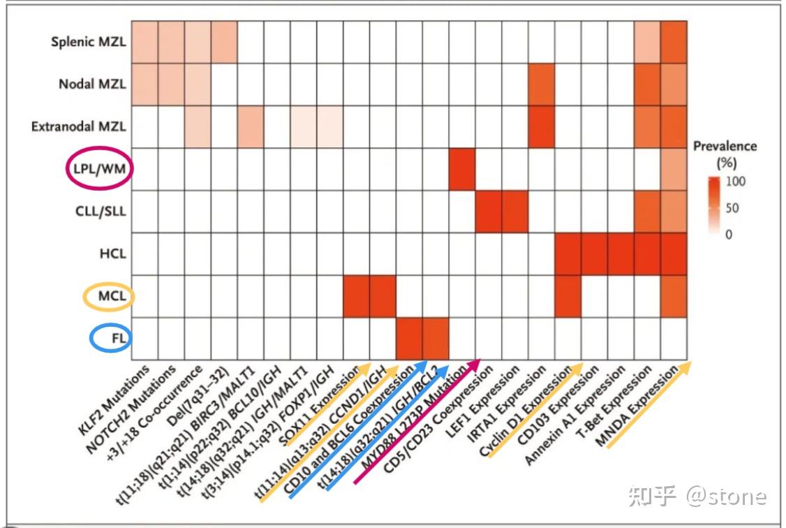 边缘区淋巴瘤-MZL - 知乎