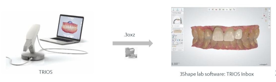 3shape口扫应用——数据传输 - 知乎