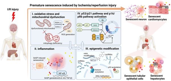 Cell Death Discov 综述︱陈潮金等评述细胞衰老在缺血再灌注损伤中的研究进展 - 知乎