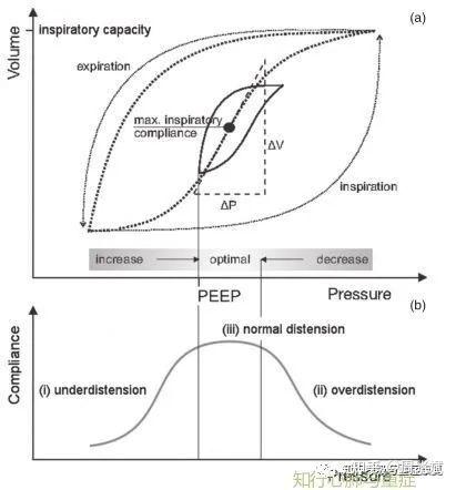 第149期 滴定PEEP的9个方法 - 知乎