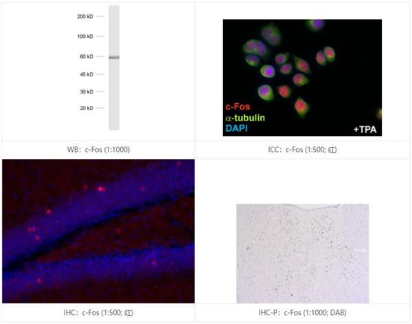原癌蛋白c-Fos抗体【c-Fos - 226 004 抗体】 - 知乎