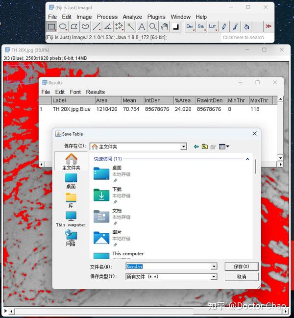 组化片子如何利用Image J 进行阳性信号面积占比统计分析 - 知乎
