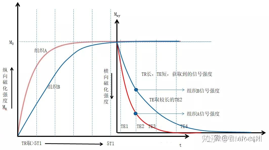 磁共振成像：对PDW T1W T2W 三种加权图像的理解 - 知乎