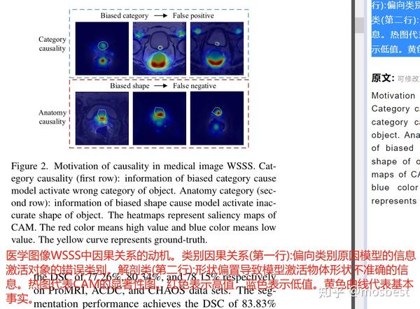 CVPR: C-CAM: Causal CAM for Weakly Supervised Semantic Segmentation on Medical Image - 知乎