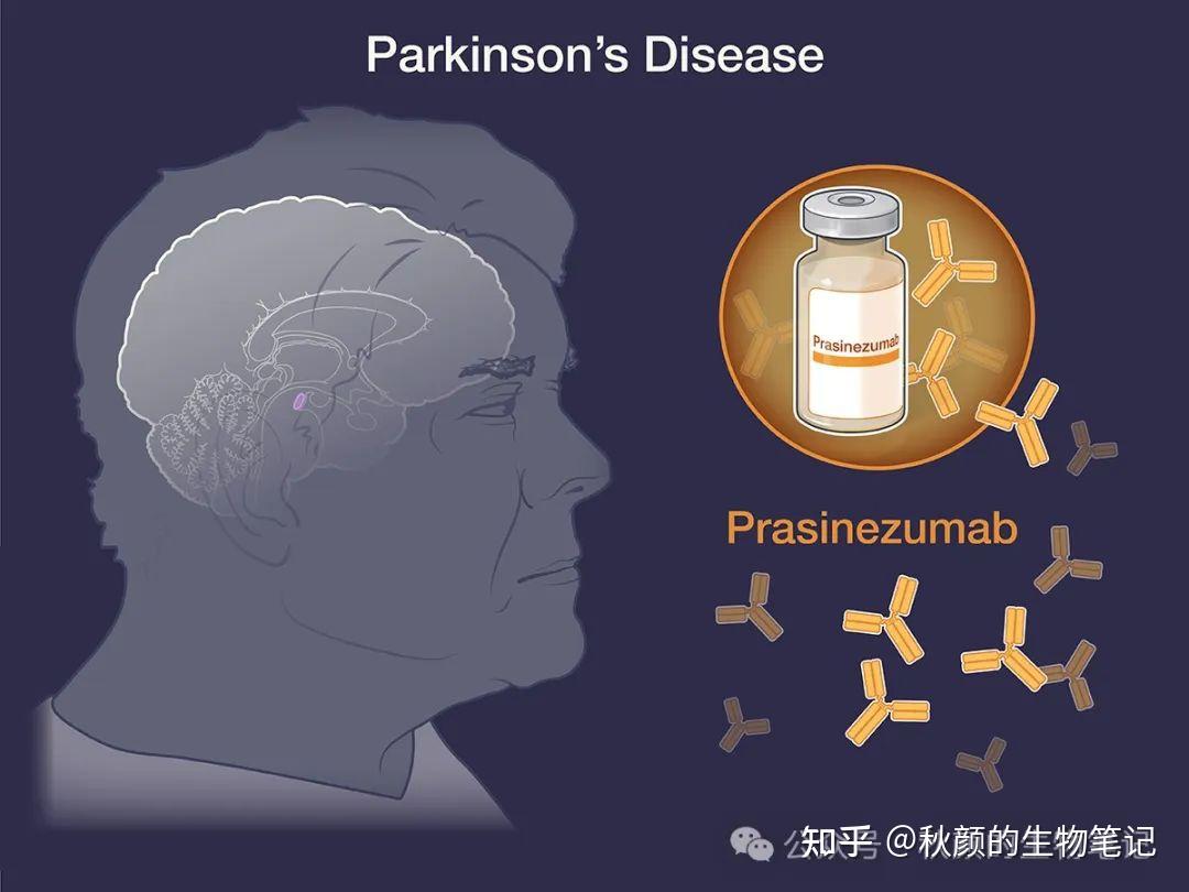 错题集| 为什么罗氏的Prasinezumab 在帕金森二期临床失败了？ - 知乎
