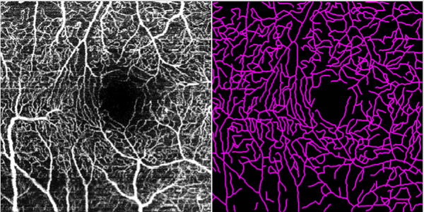 ROSE 数据集介绍 - 知乎