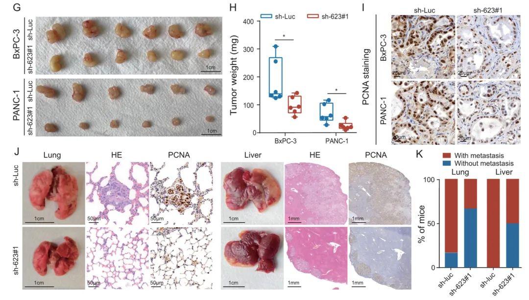 科研思路丨J Hematol Oncol（IF23+）丨外泌体lncRNA测序助力发现LINC00623促进胰腺癌进展的分子机制 - 知乎