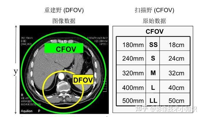 CT的扫描野和显示野 - 知乎