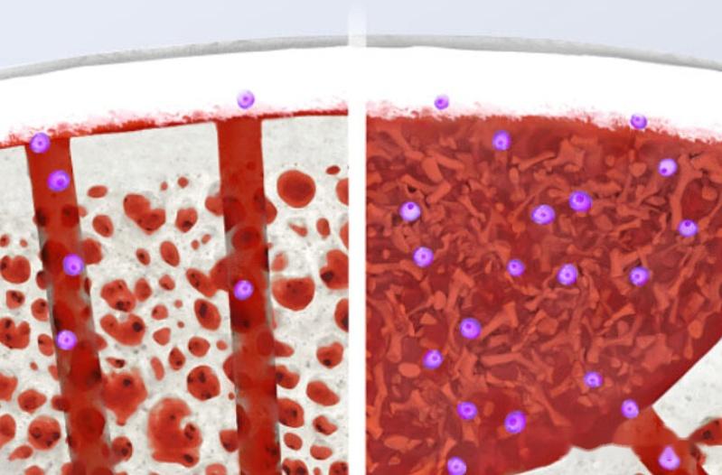 骨再生大咖：瑞士盖氏的故事 - 知乎