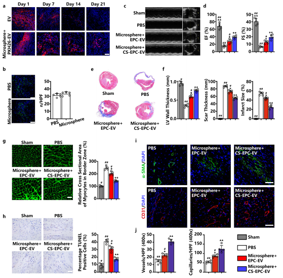 Nat Commun|南方医科大学区彩文/中国科学院大学常江教授团队联合揭示硅酸盐离子调节内皮祖细胞分泌高活性细胞外囊泡治疗心肌梗死的作用机制 - 知乎