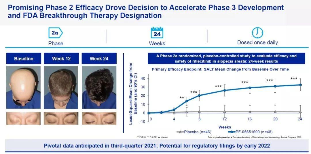 可恢复80%头发生长，斑秃新药获FDA批准 - 知乎
