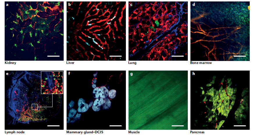 Nat Rev | 活体成像研究癌症的发展和转移 - 知乎