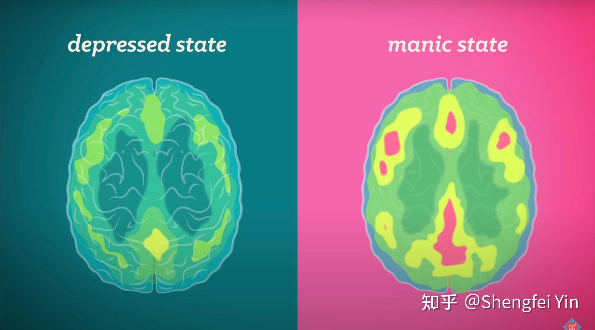 Depressive & Bipolar Disorders - Crash Course Psychology #30 - 知乎