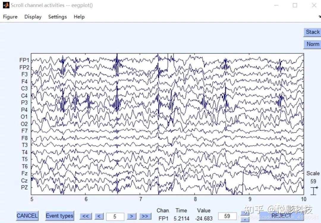 如何利用EEGlab工具包在EEG数据中手动插入Marker？ - 知乎