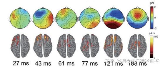 TMS-EEG：认知功能和临床应用研究 - 知乎