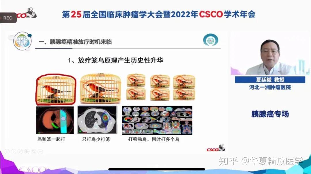 2022CSCO学术年会夏廷毅：精准放疗是治疗胰腺癌的重要手段 - 知乎