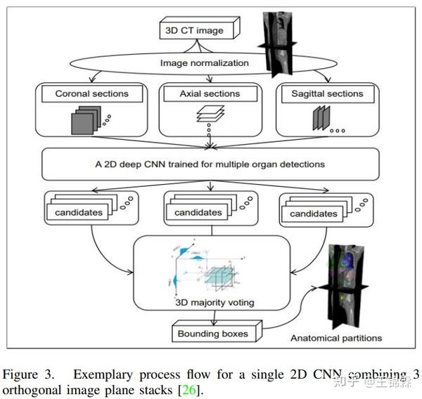 综述文章：医学图像中的3D 目标检测 - 知乎