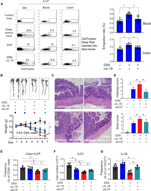 Sci Adv︱刘庆洋等揭示骨髓中ILC 前体细胞外迁机制以及其对肠道炎症中的组织保护作用 - 知乎