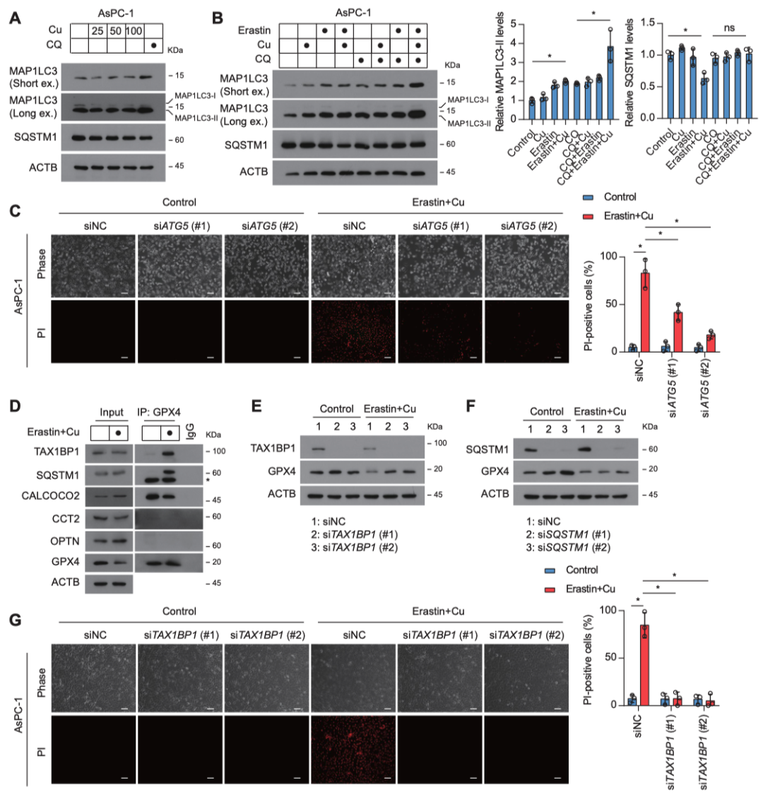 Autophagy丨GPX4 的铜依赖性自噬降解驱动铁死亡 - 知乎