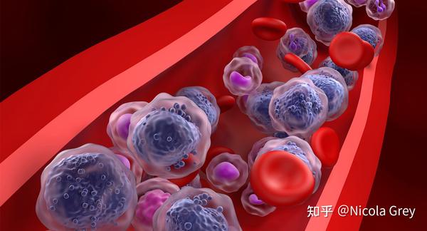 2023年末重磅：Rezlidhia(olutasidenib)未来可用于治疗复发或难治性 (R/R) AML、高危骨髓增生异常综合征(MDS ...