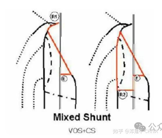 CHIVA语言中的Shunt概念与分类 - 知乎