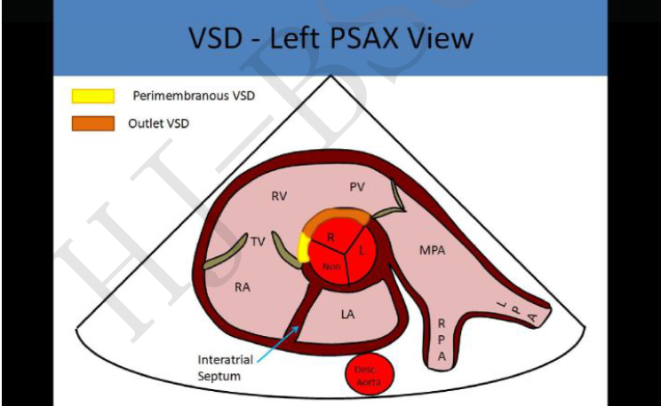 大神笔记来了：美国心脏超声考试全攻略！ - 知乎