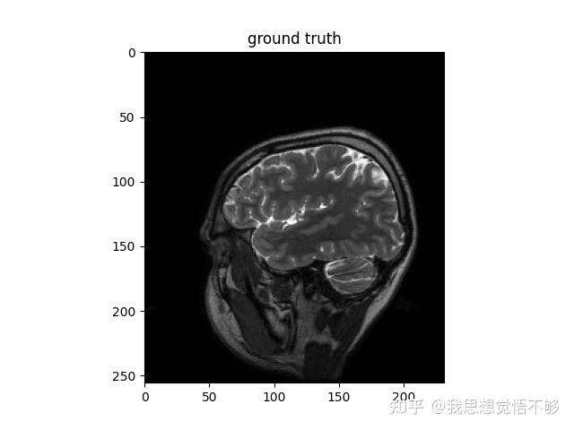 MRI重建中的小实验（python） - 知乎