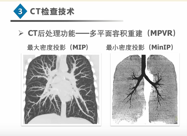 医学图像技术积累 - 知乎