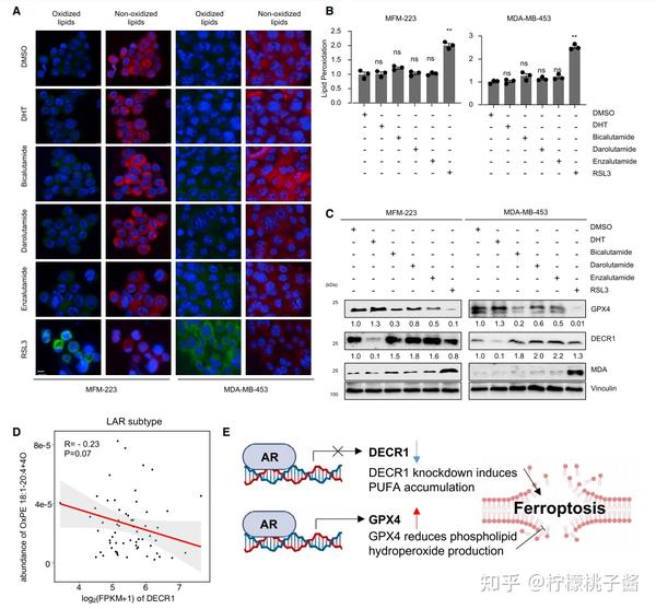 Cell Metab | 邵志敏/江一舟团队揭示三阴性乳腺癌铁死亡异质性 - 知乎