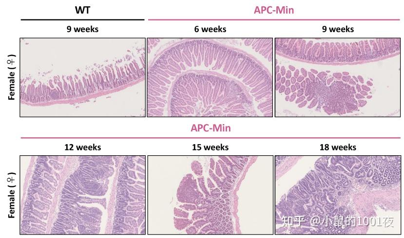 APC-Min小鼠｜肠道肿瘤小鼠模型 - 知乎