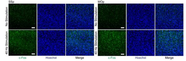MIT蔡立慧团队最新报道40Hz震动刺激改善AD病理和运动表现 - 知乎