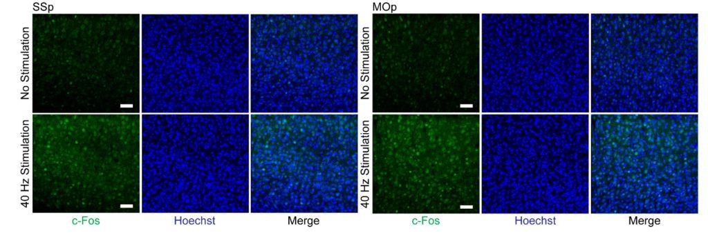 MIT蔡立慧团队最新报道40Hz震动刺激改善AD病理和运动表现 - 知乎
