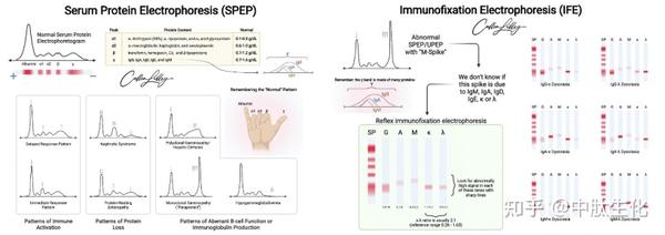 个性化追踪M蛋白, EasyM推进骨髓瘤的精准医学实践 - 知乎
