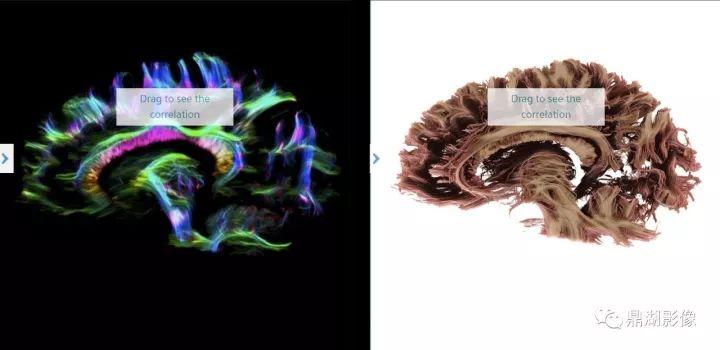 重大突破！临床磁共振进入7T时代！ - 知乎