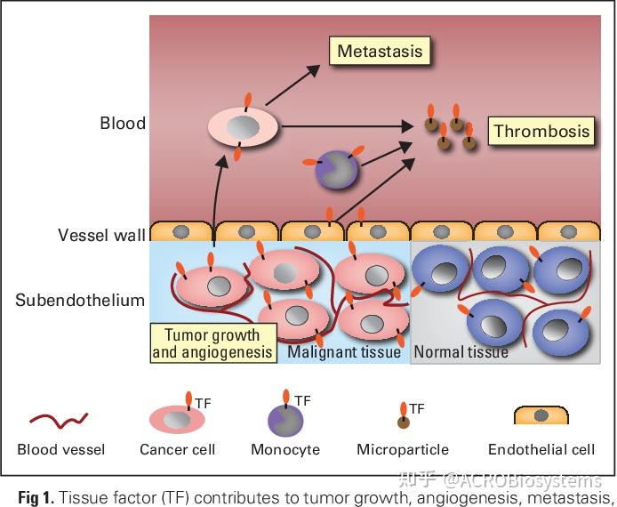 女性肿瘤药物王者抢滩千亿级ADC赛道，创新靶点TF引人瞩目 - 知乎