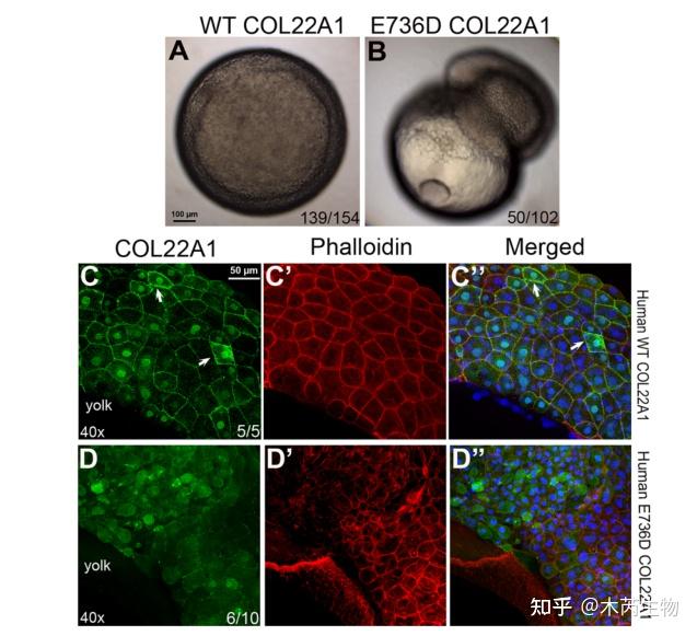 【文献解读】胶原COL22A1维持血管稳定性，COL22A1突变可能与颅内动脉瘤有关 - 知乎